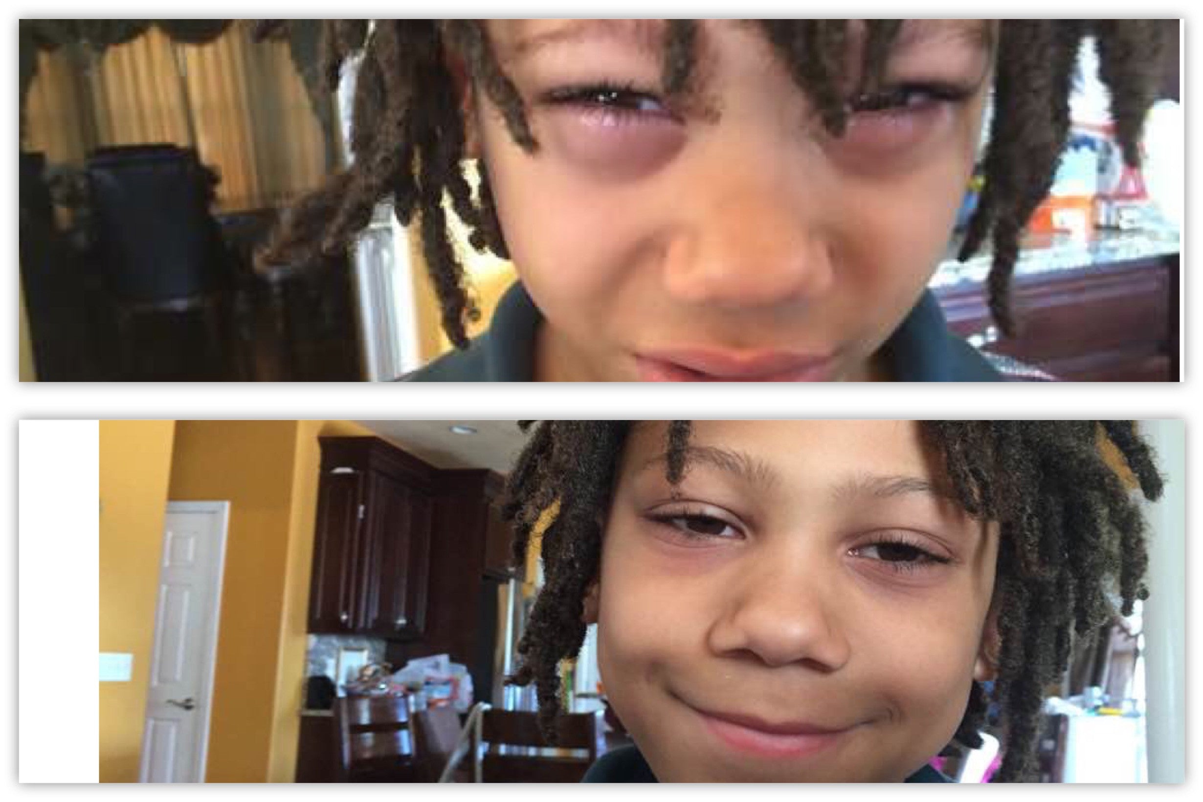 Colloidal Silver Healing Eye Irritations From Allergies – Hebrew Care